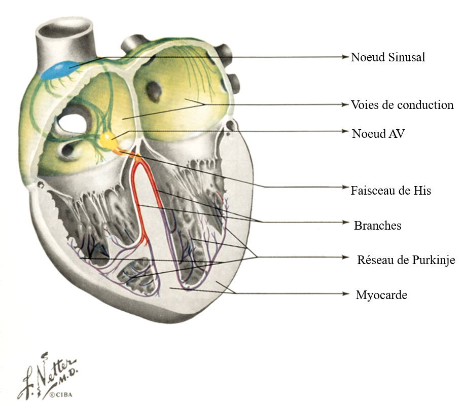 3 - Les troubles de la conduction auriculo-ventriculaire / Pacemaker ...